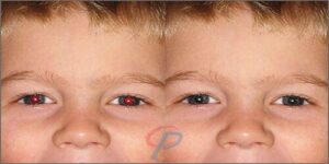 Photo Retouching Services From Best Photoshop Retouchers